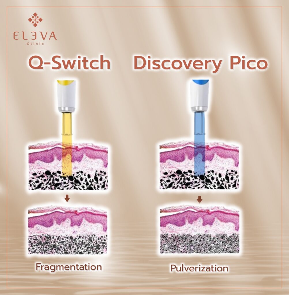 Discovery pico - Eleva Clinic